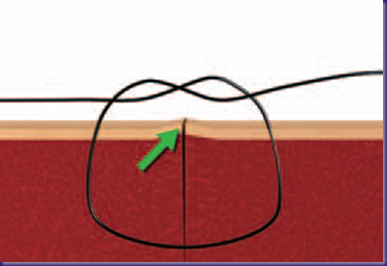 carol's scribbles: Suturing Banana(Edited version)